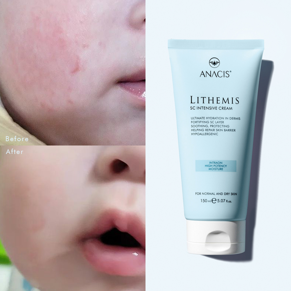 POOM | 리더미스 보습 크림 150ml 4개 세라마이드